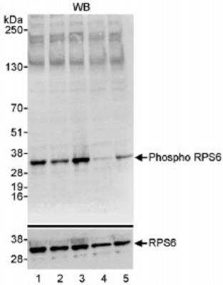 Ribosomal Protein S6/RPS6 [p Ser235, p Ser236] Antibody (NB100-1553 ...